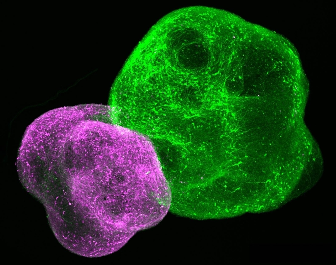 Scientists restore brain cells impaired by a rare genetic disorder ...